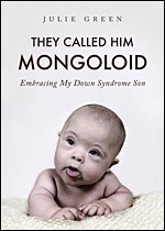 European Down Syndrome Sufferers were not born in Mongolia – SANGHA ...