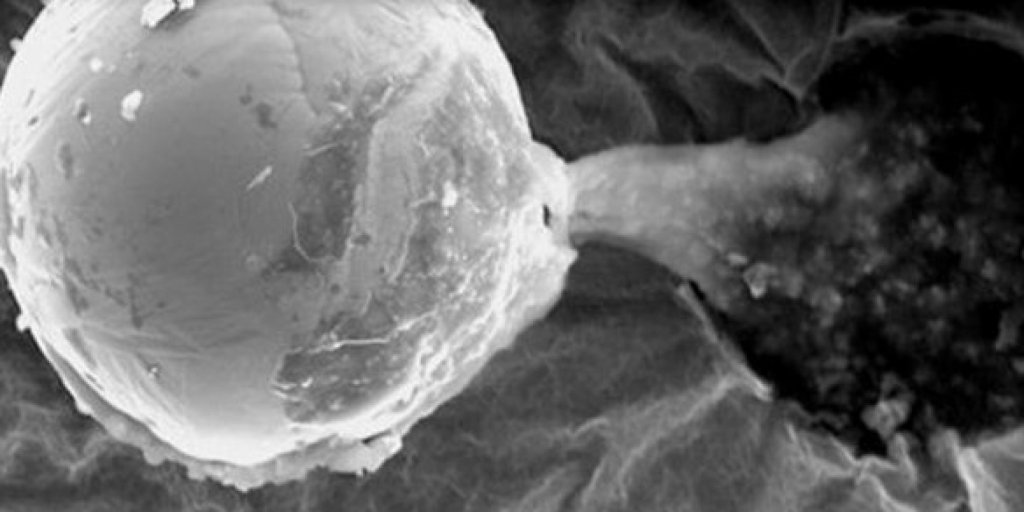 Has Britain’s Prof. Milton Wainwright Discovered Extraterrestrial Life ...